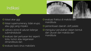 Occlusal Radiograph.pptx