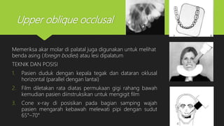 Occlusal Radiograph.pptx