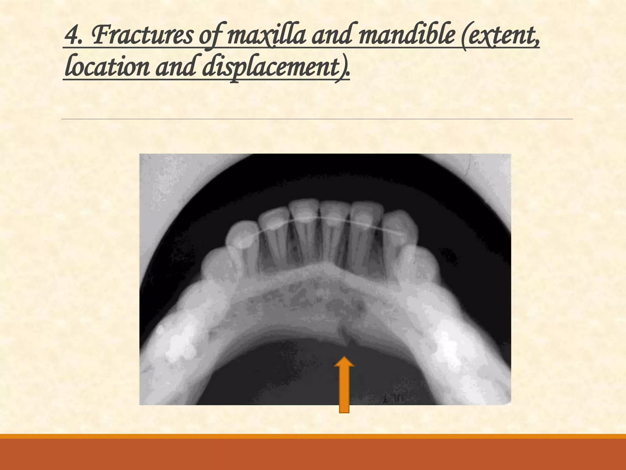 Occlusal radiography | PPTX
