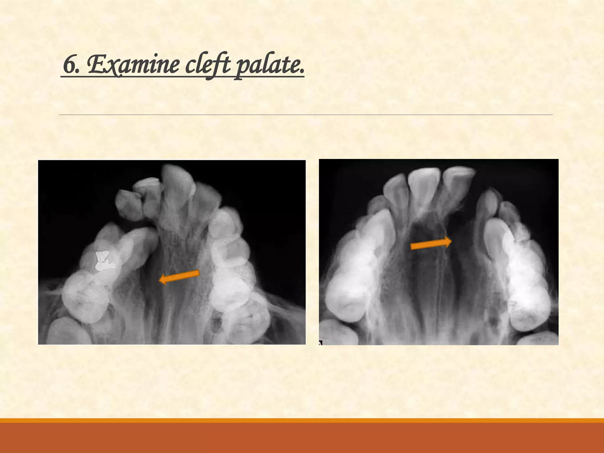 Occlusal radiography | PPTX