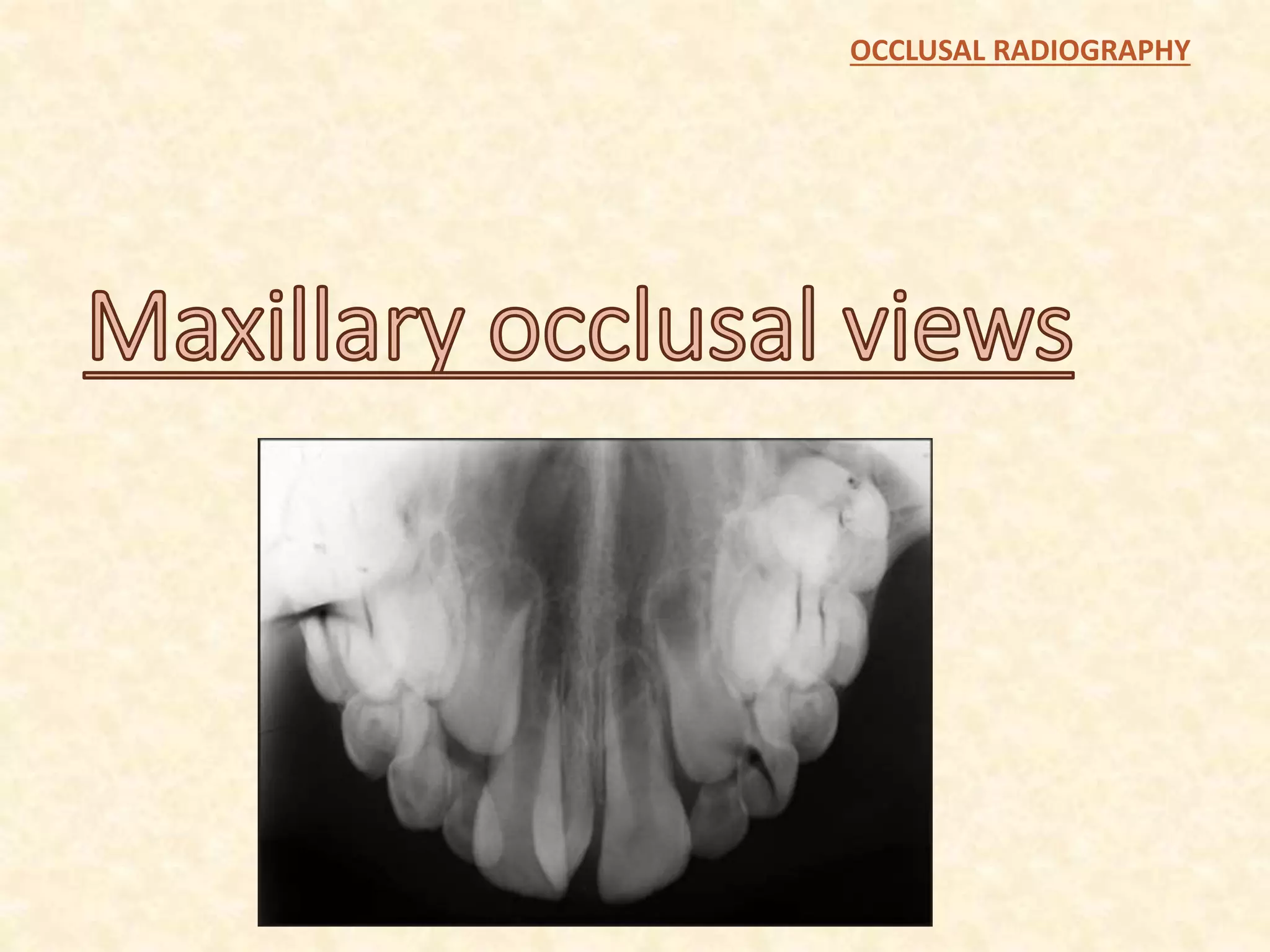Occlusal radiography | PPTX