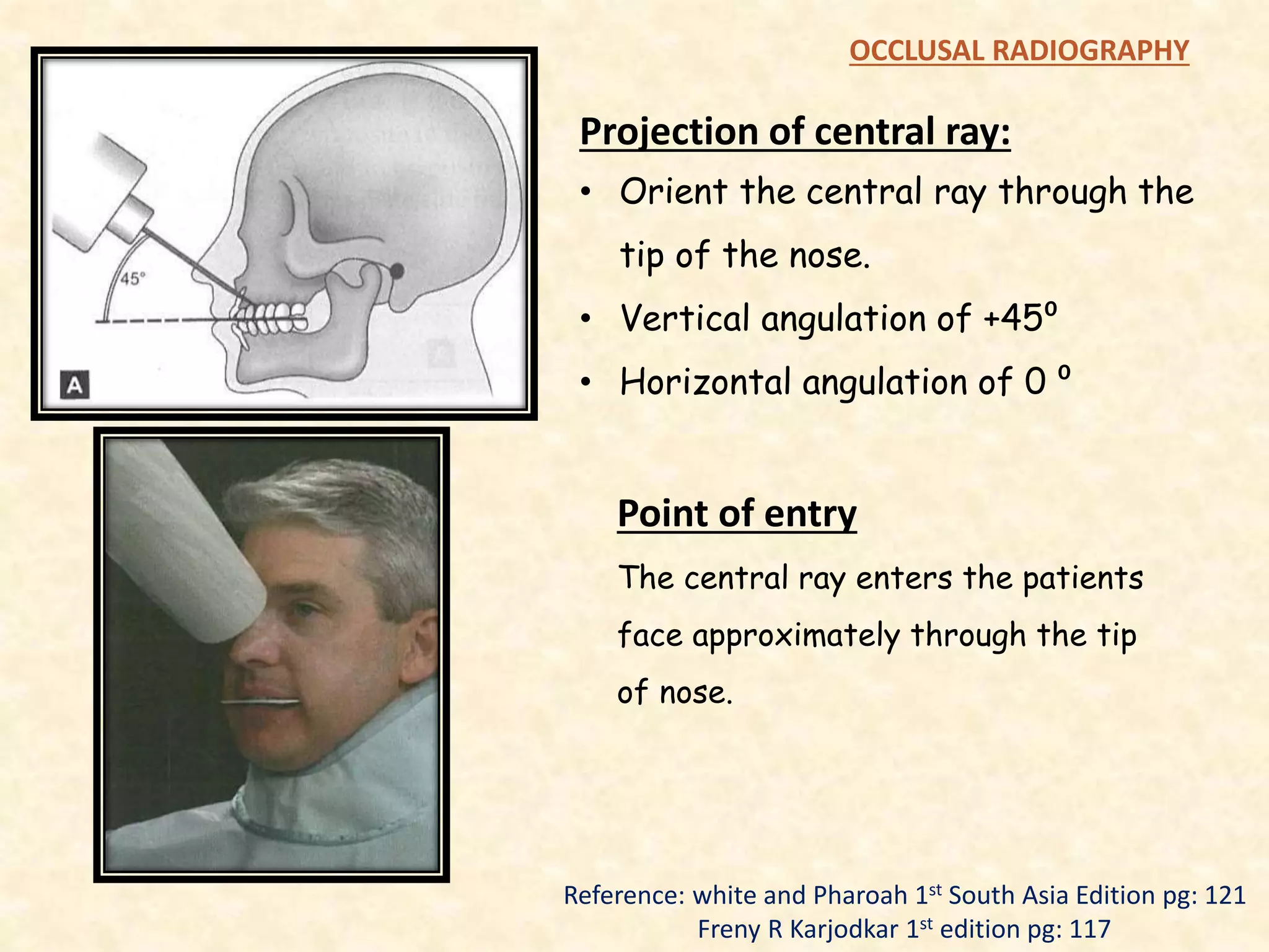 Occlusal radiography | PPTX