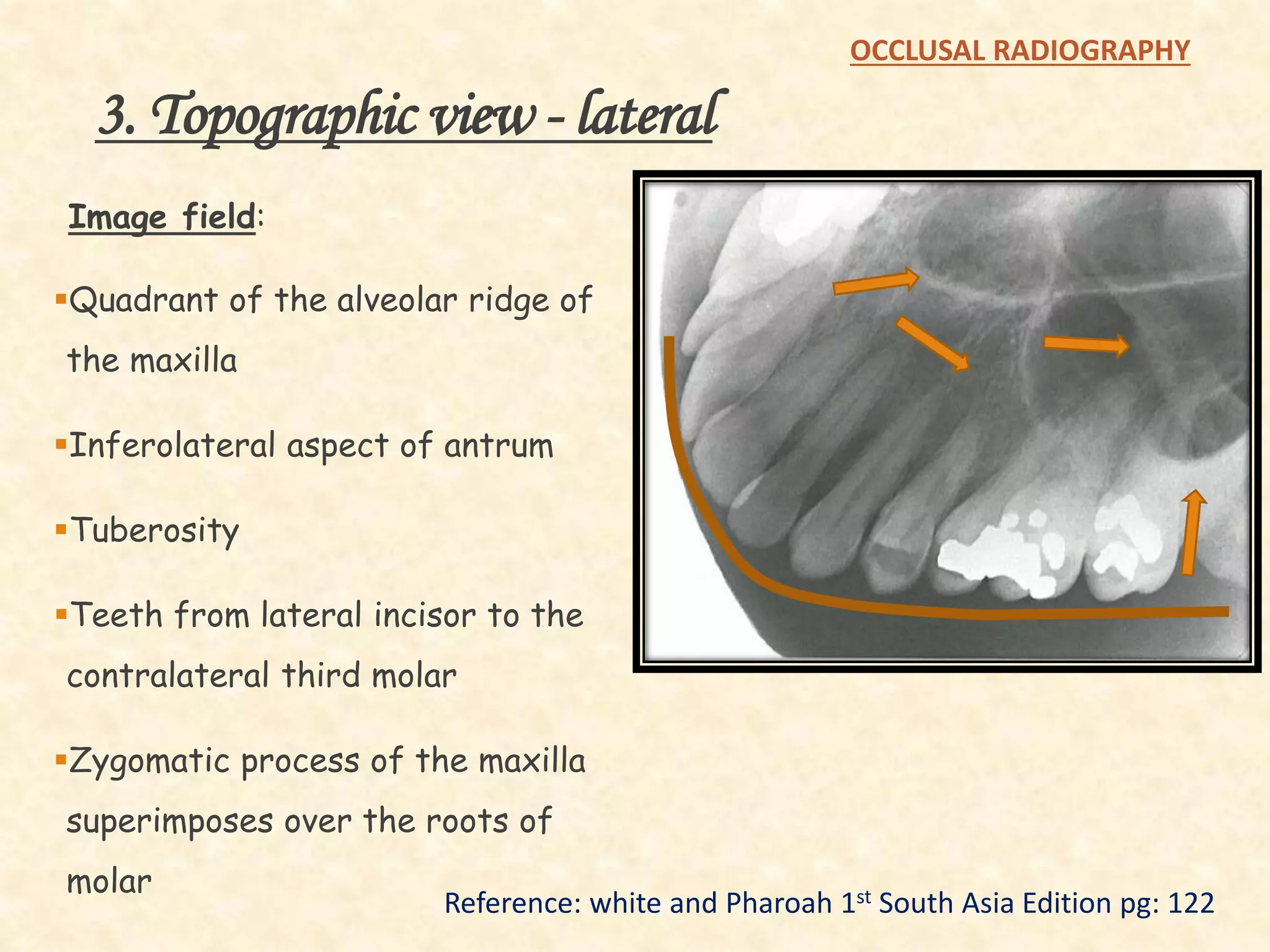 Occlusal radiography | PPTX