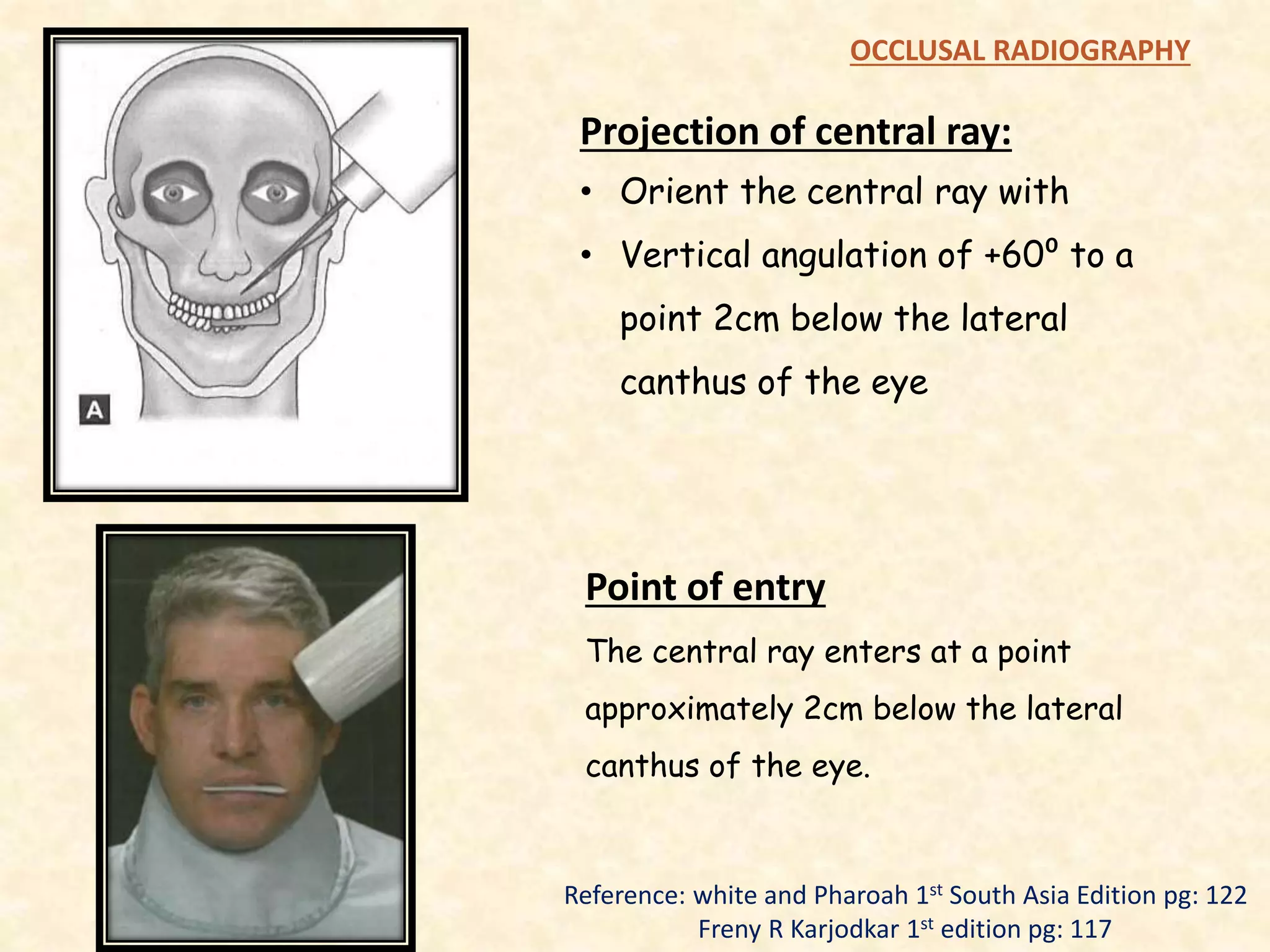 Occlusal radiography | PPTX
