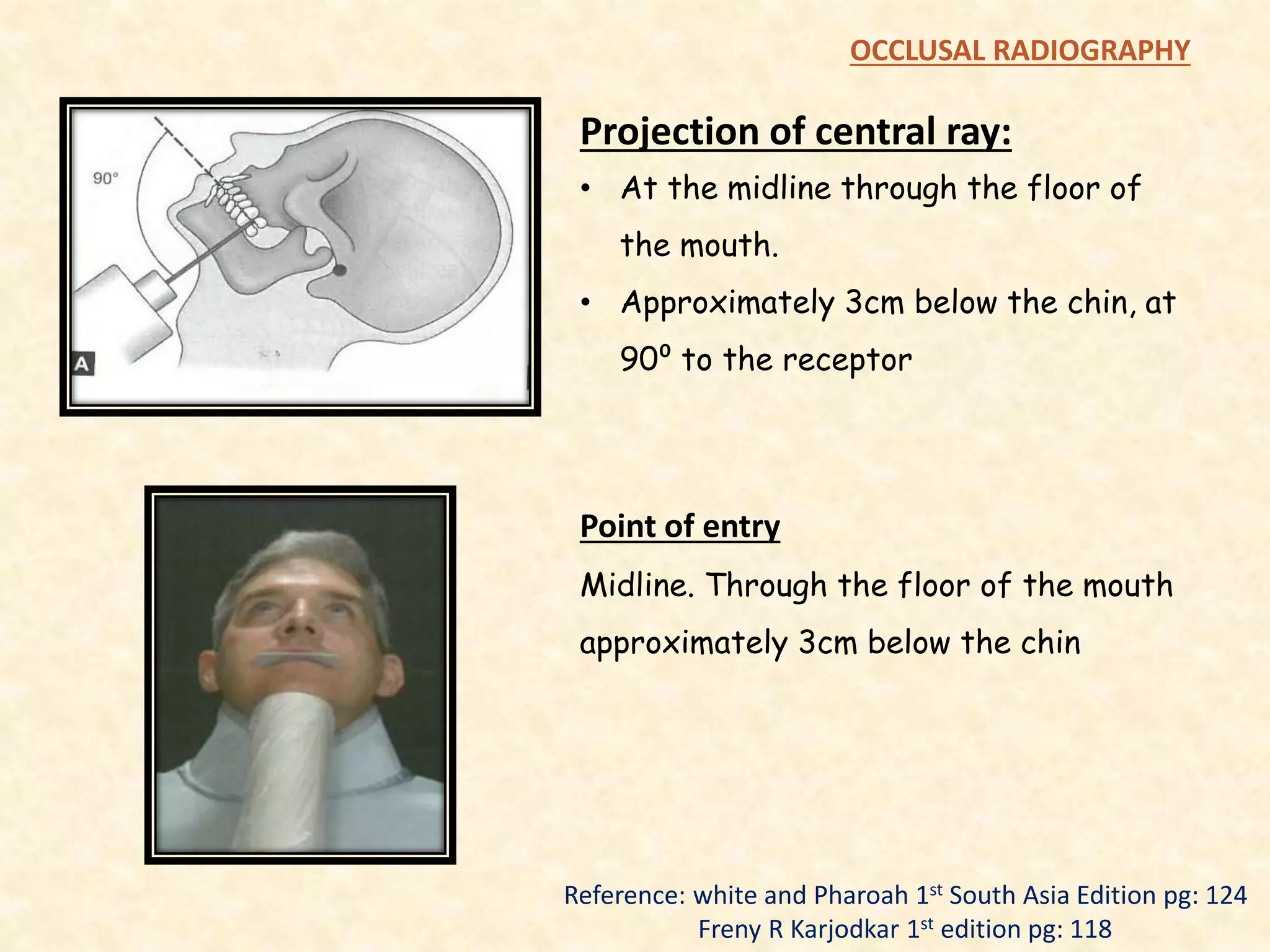 Occlusal radiography | PPTX