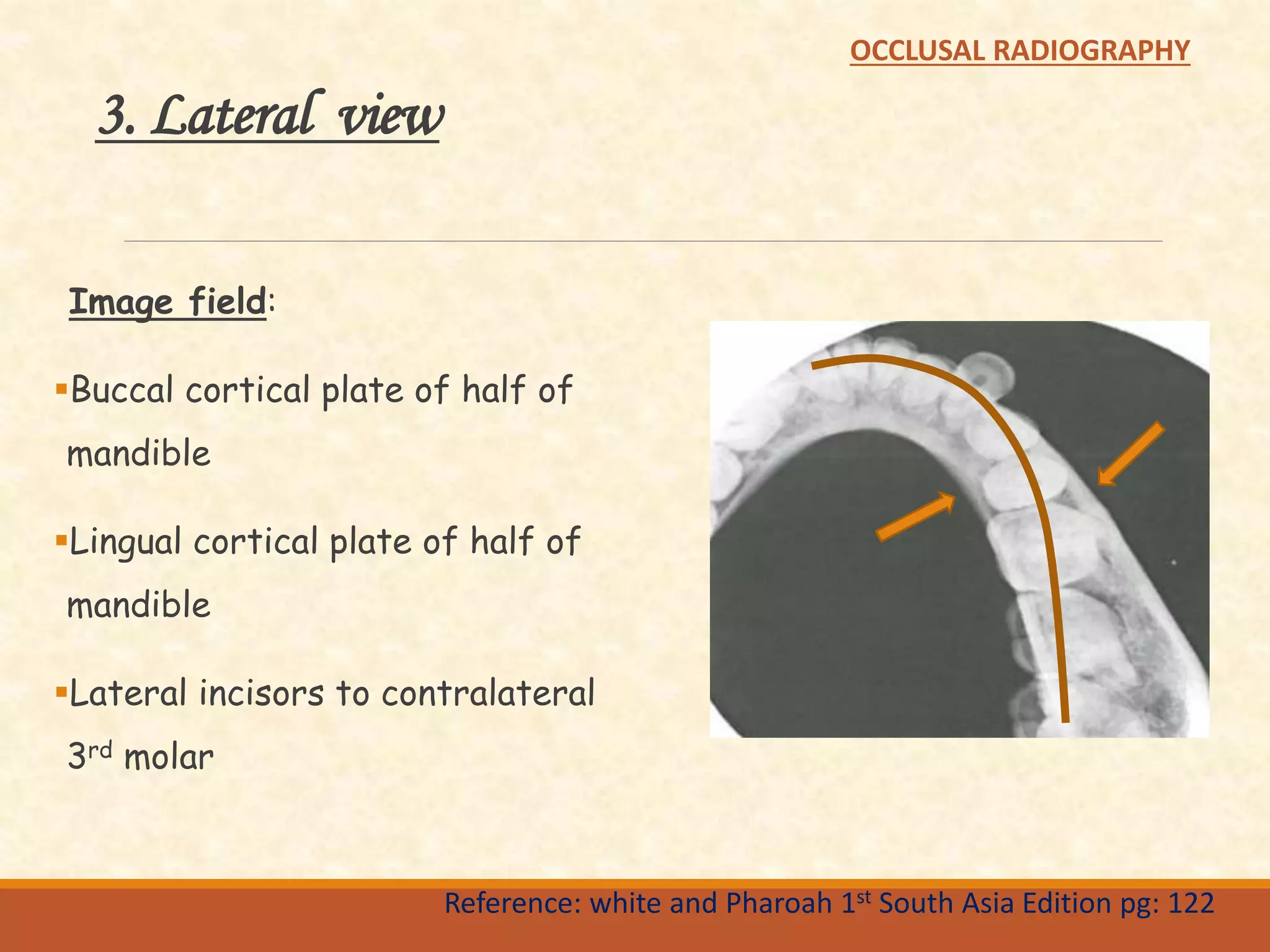 Occlusal radiography | PPTX