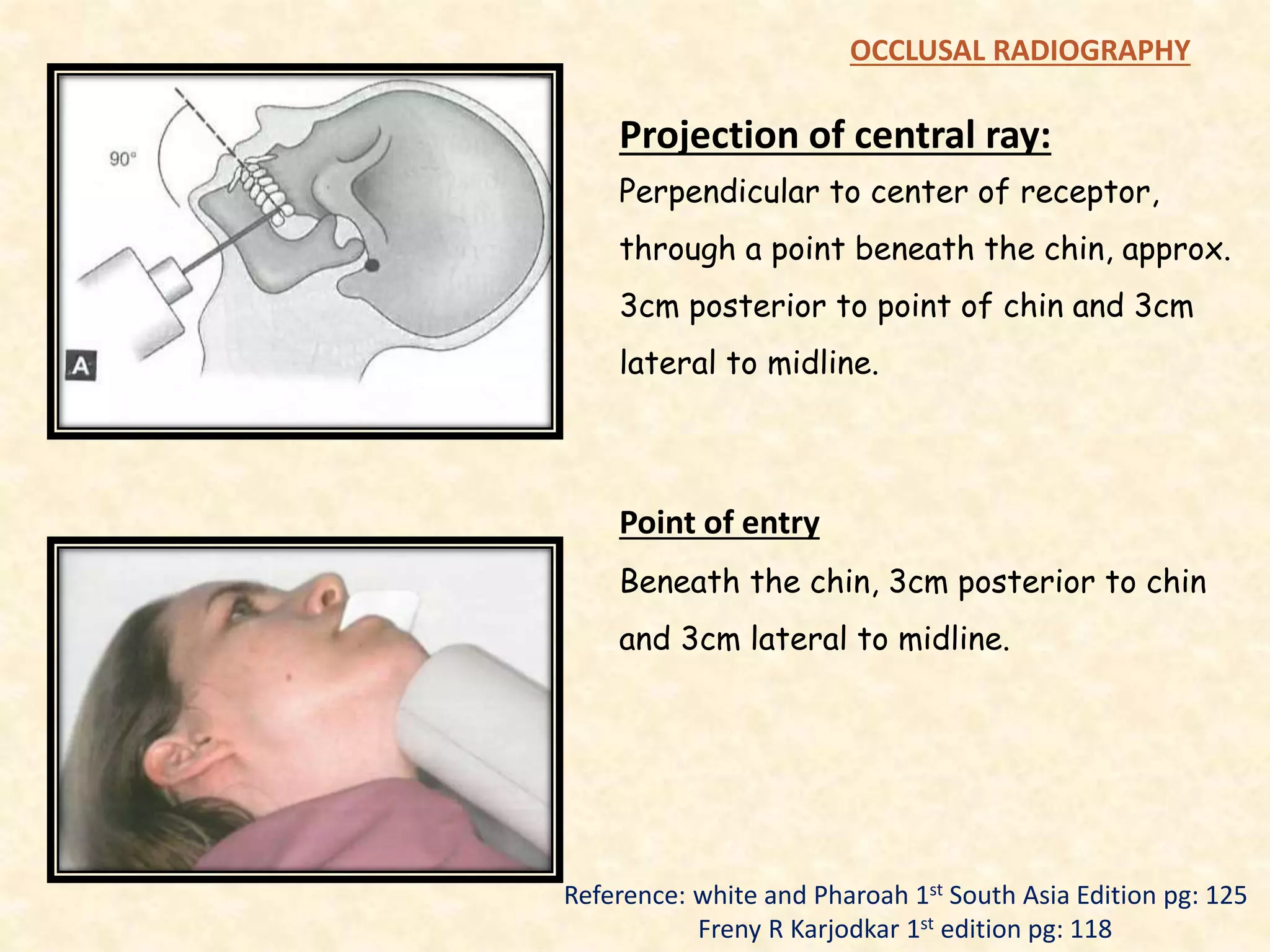 Occlusal radiography | PPTX