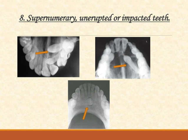 Occlusal radiography | PPTX | Dental Health | Diseases and Conditions