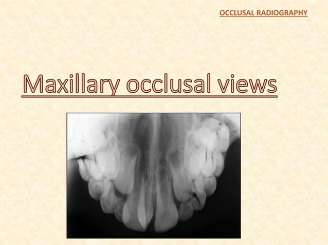 Occlusal radiography | PPTX | Dental Health | Diseases and Conditions