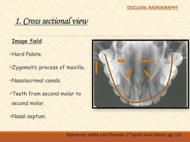 Occlusal radiography | PPTX | Dental Health | Diseases and Conditions
