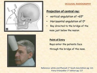Occlusal radiography | PPTX