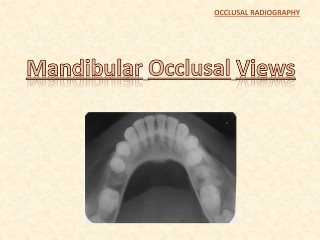 Occlusal radiography | PPTX | Dental Health | Diseases and Conditions