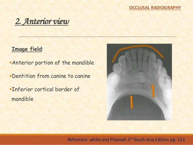 Occlusal radiography