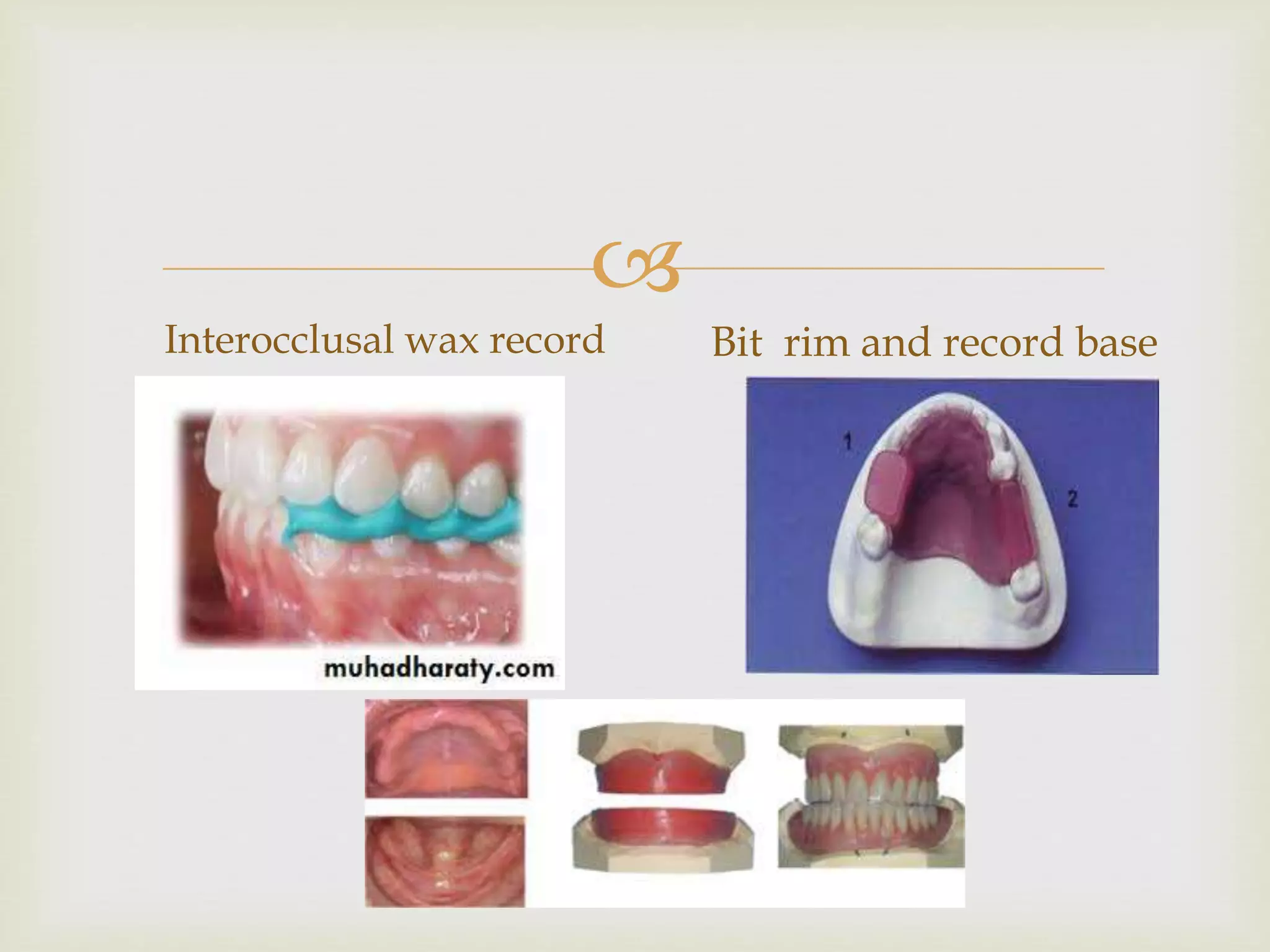 Occlusal relationship for removable partial denture | PPTX