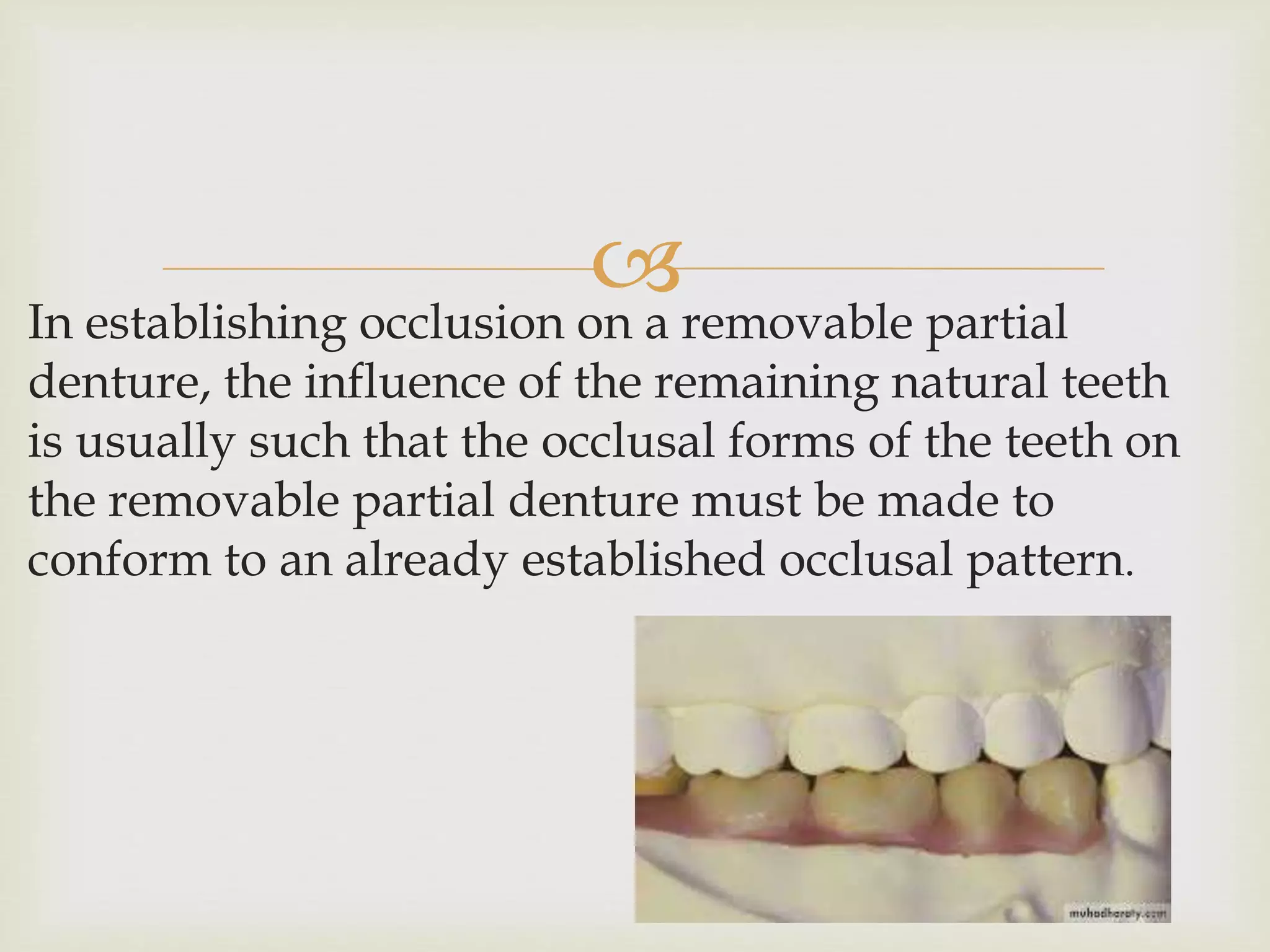 Occlusal relationship for removable partial denture | PPTX