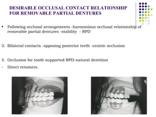 Occlusal relationship in_rpd__prostho_ | PPT
