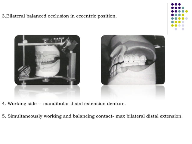 Occlusal relationship in_rpd__prostho_ | PPT
