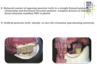 Occlusal relationship in_rpd__prostho_ | PPT