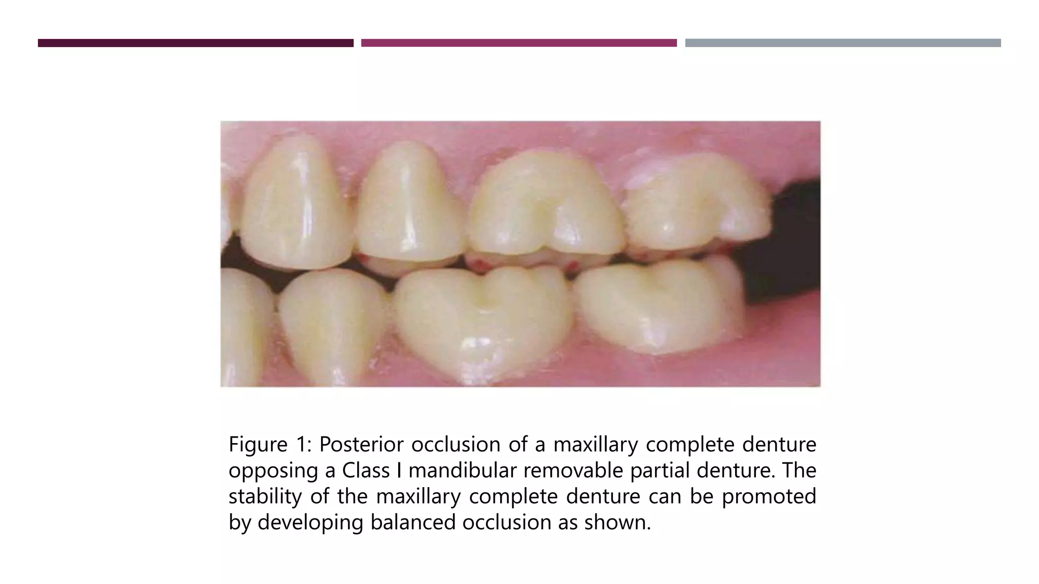 occlusal relationships for rpd -protik.pptx