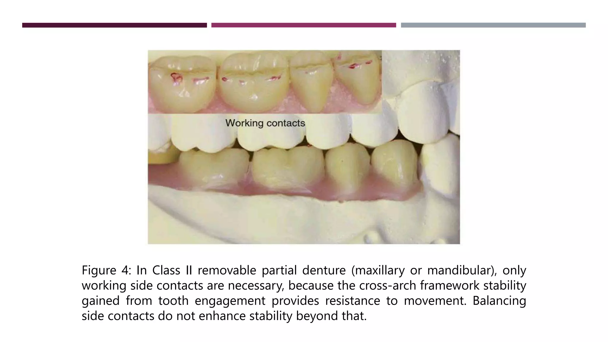 occlusal relationships for rpd -protik.pptx