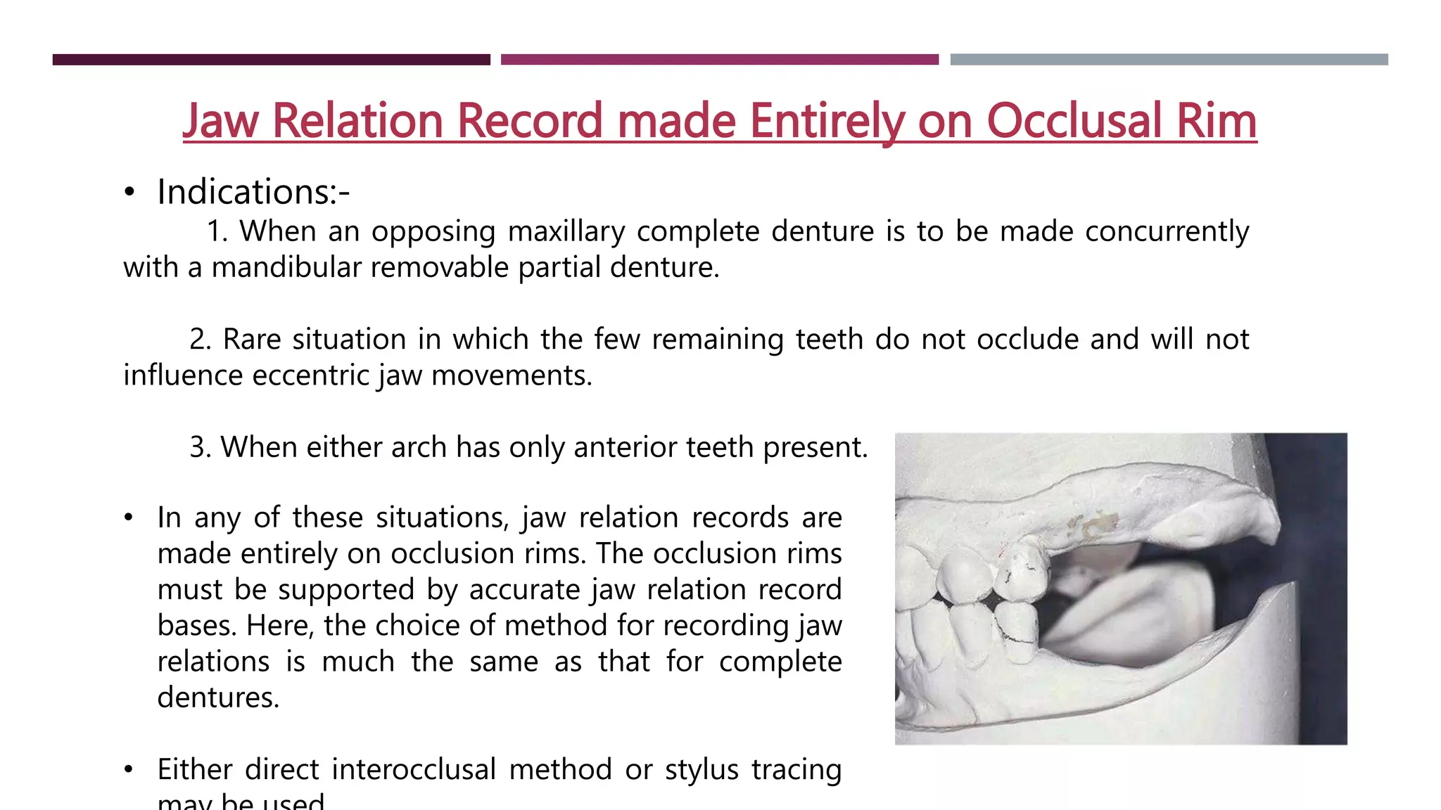 occlusal relationships for rpd -protik.pptx