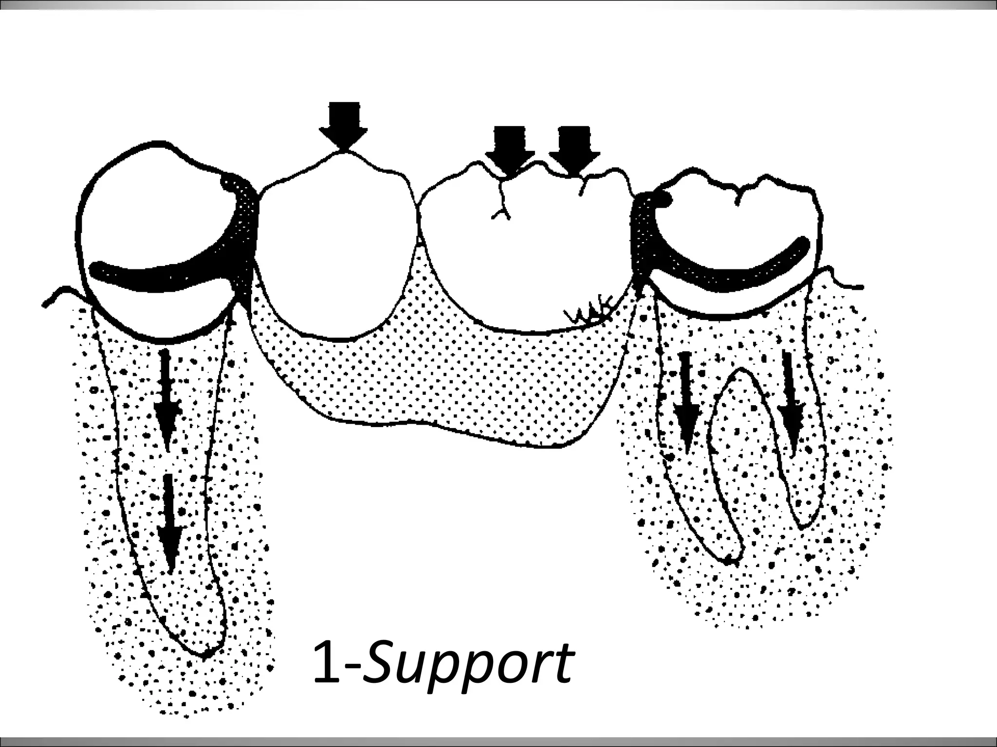 Occlusal rests | PPT