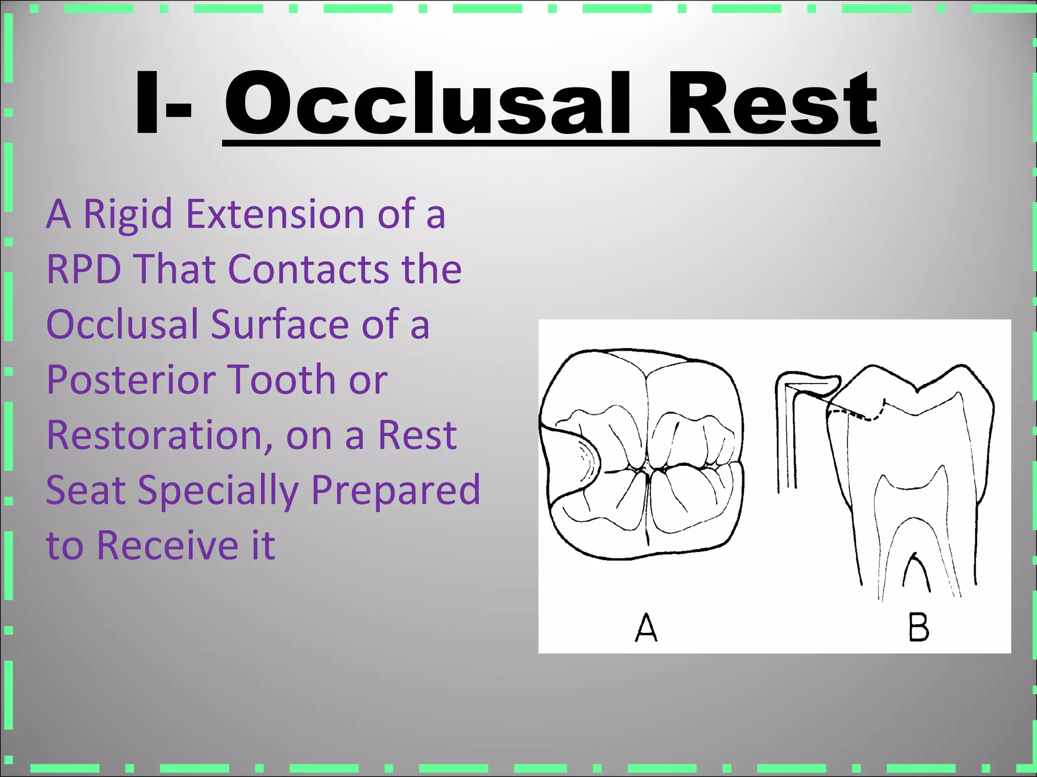 Occlusal rests | PPT