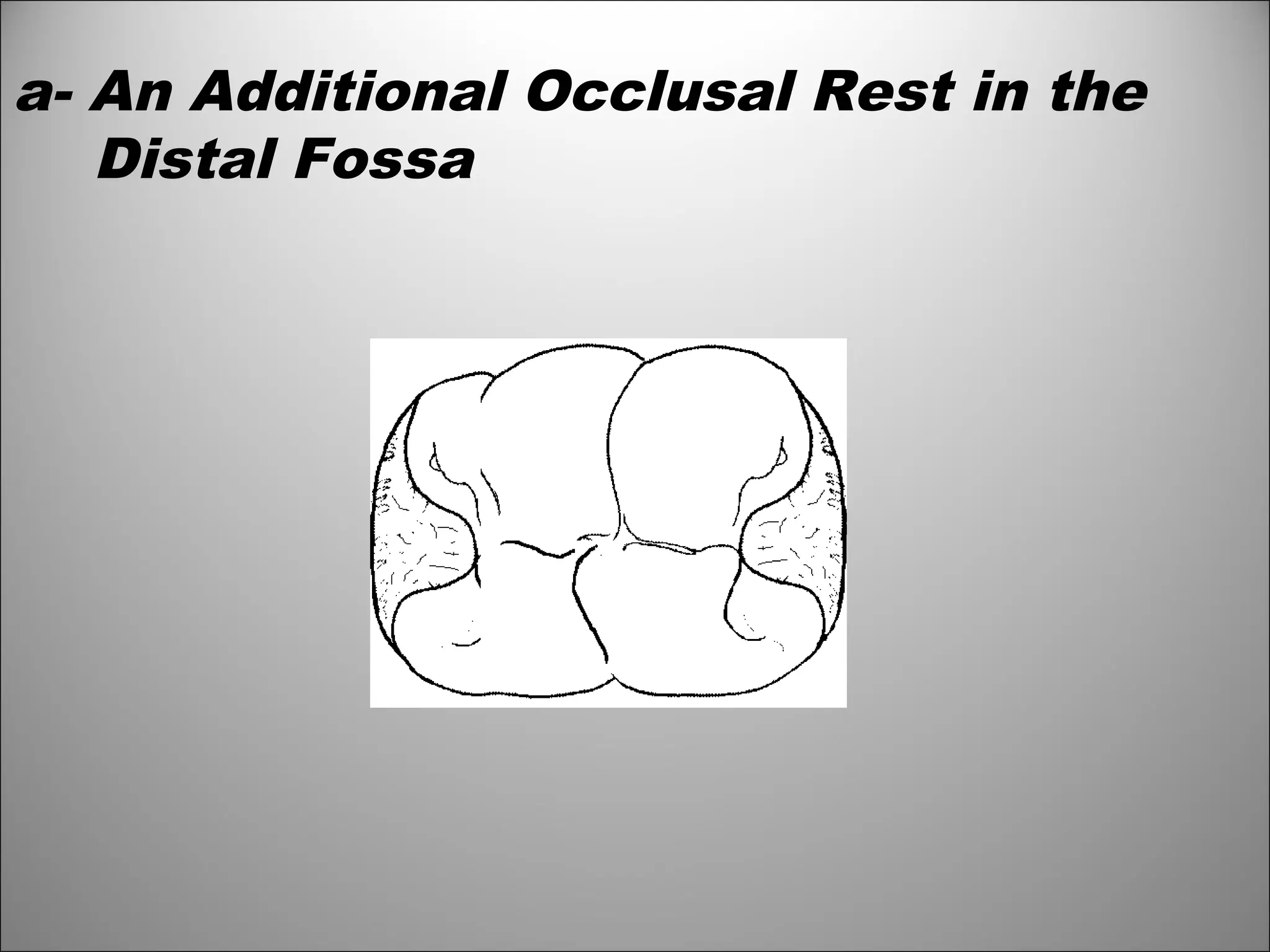 Occlusal rests | PPT
