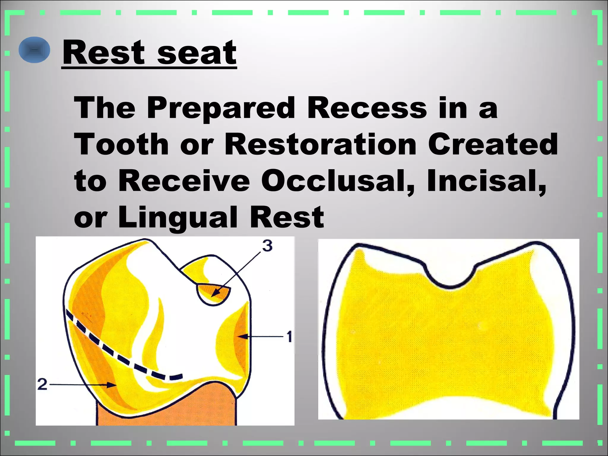 Occlusal rests | PPT