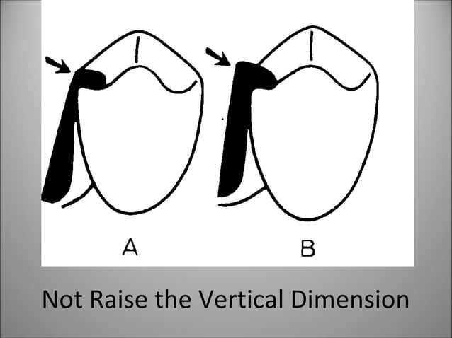 Occlusal rests | PPT | Dental Health | Diseases and Conditions