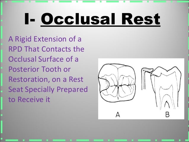 Occlusal rests