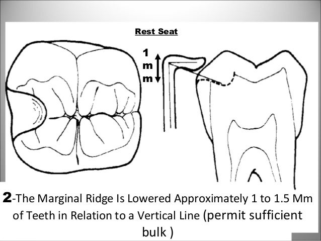 Occlusal rests