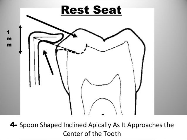 Occlusal rests