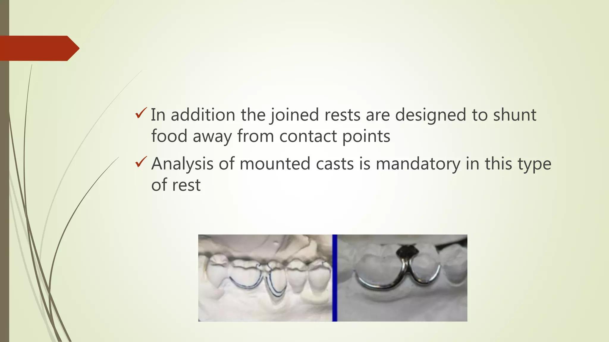 overview of occlusal rests and rest seats | PPTX