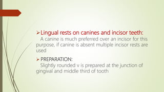 overview of occlusal rests and rest seats | PPTX