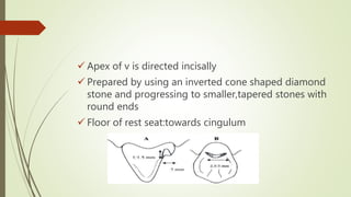 overview of occlusal rests and rest seats | PPTX