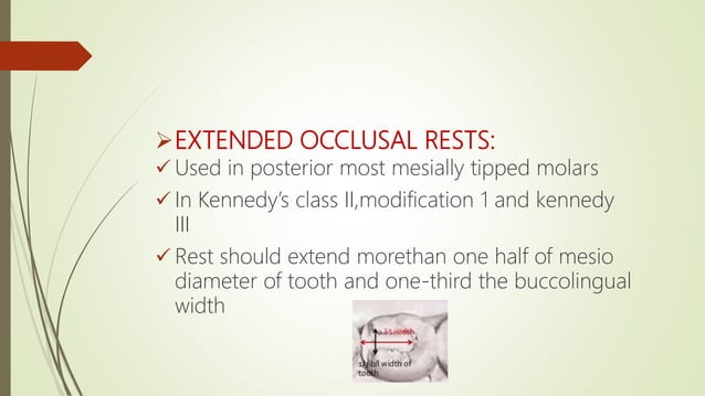 overview of occlusal rests and rest seats | PPTX