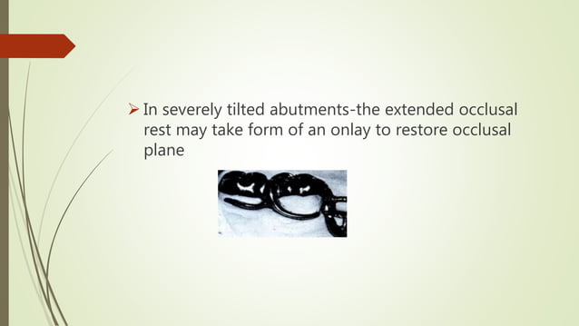 overview of occlusal rests and rest seats | PPTX