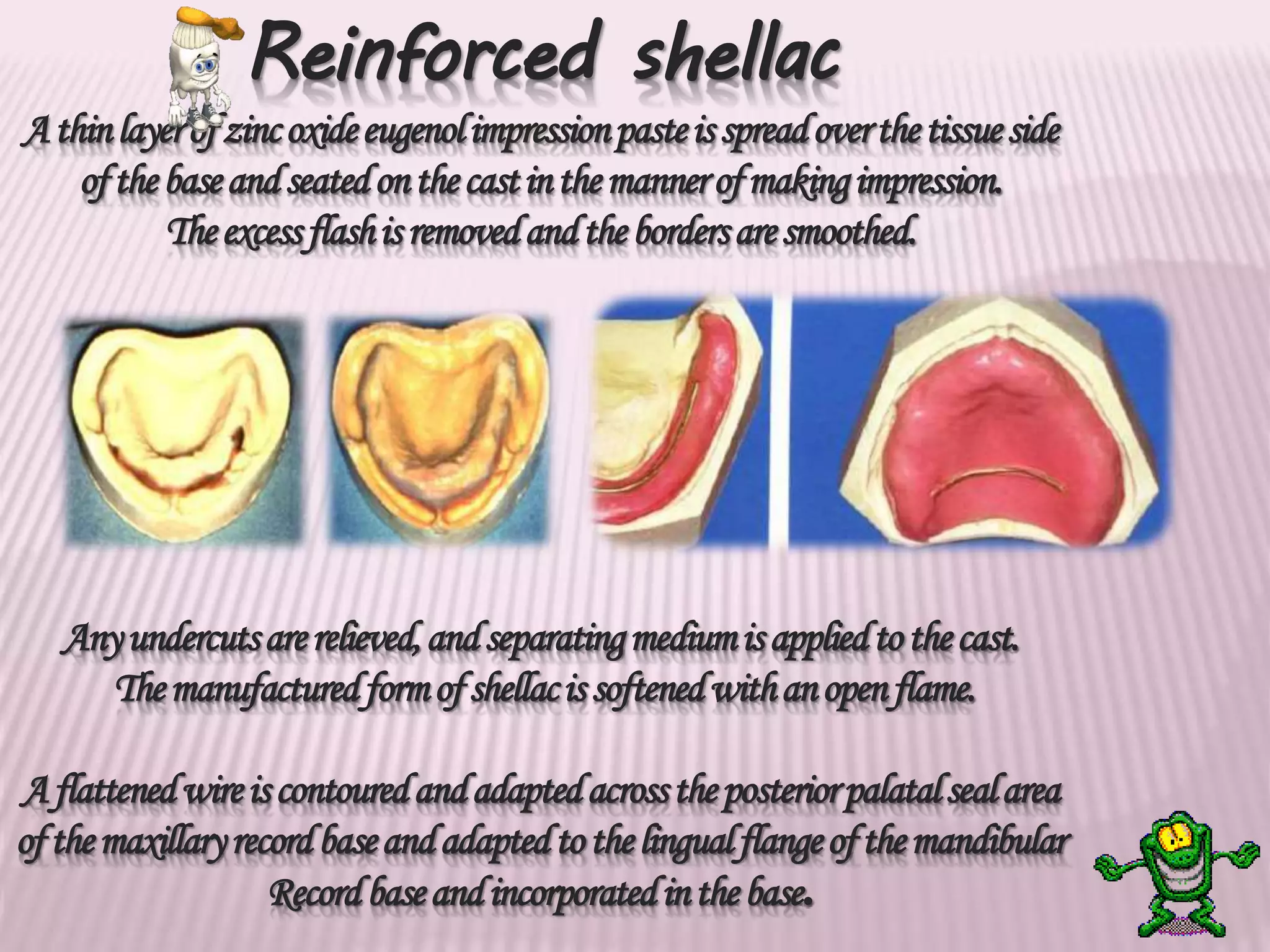 Record bases and Occlusal rims ppt | PPTX