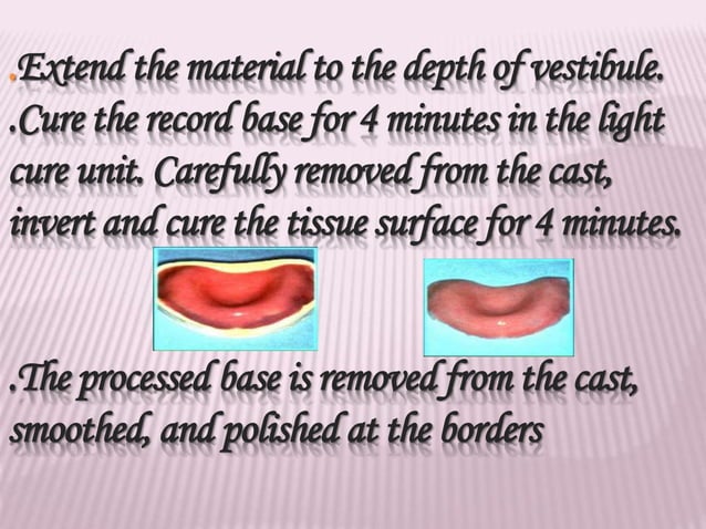 Record bases and Occlusal rims ppt | PPTX