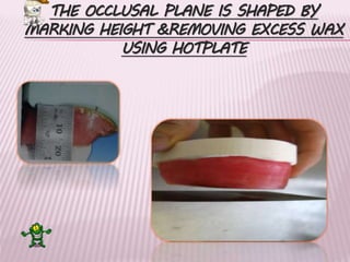 Record bases and Occlusal rims ppt | PPTX
