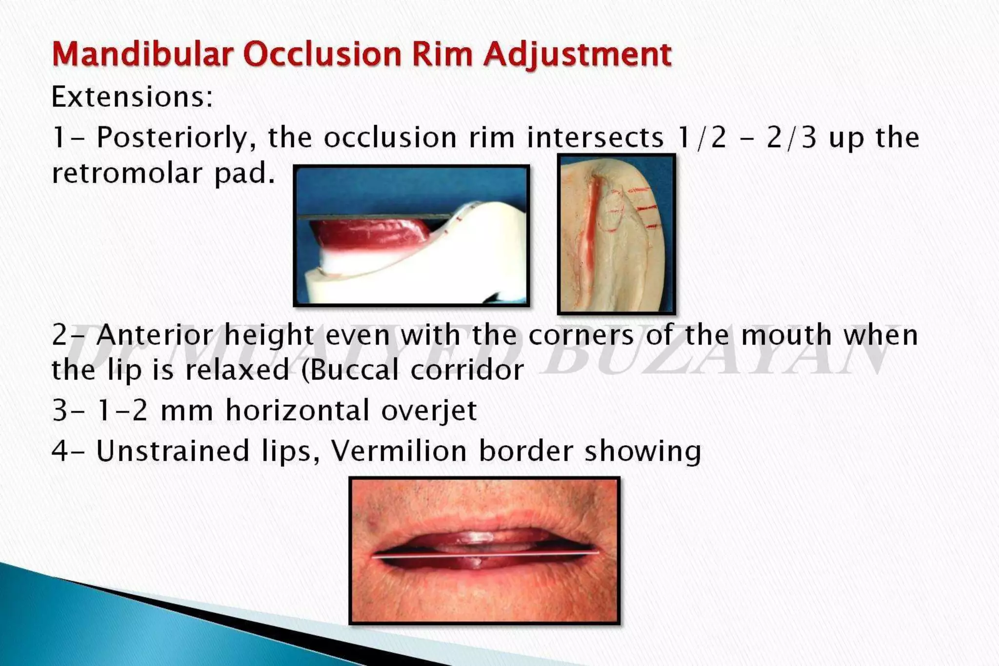 OCCLUSAL RIMS & RECORD BASE.pptx