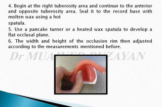 OCCLUSAL RIMS & RECORD BASE.pptx