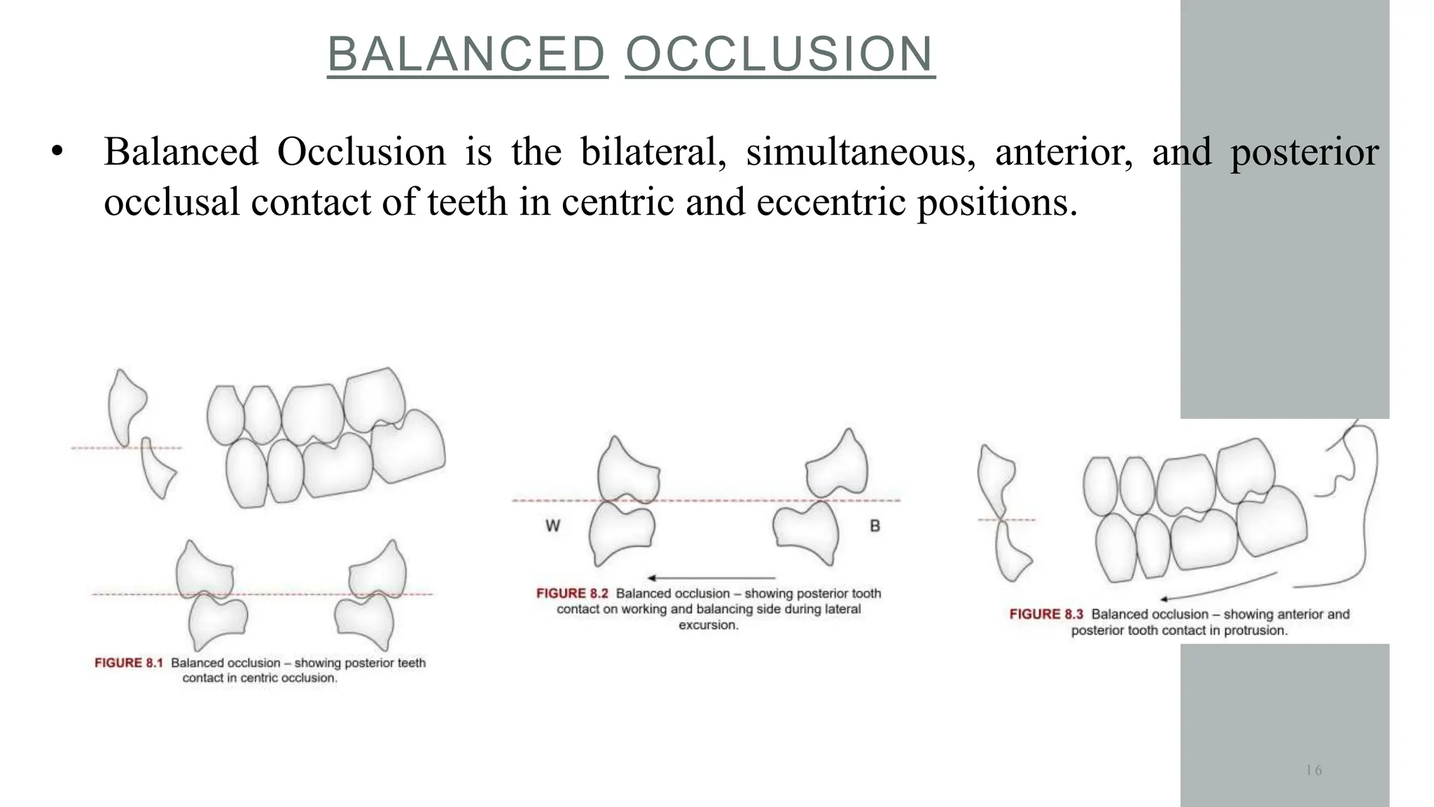 Occlusal schemes in CD_Dr Shuchi Jain.pptx