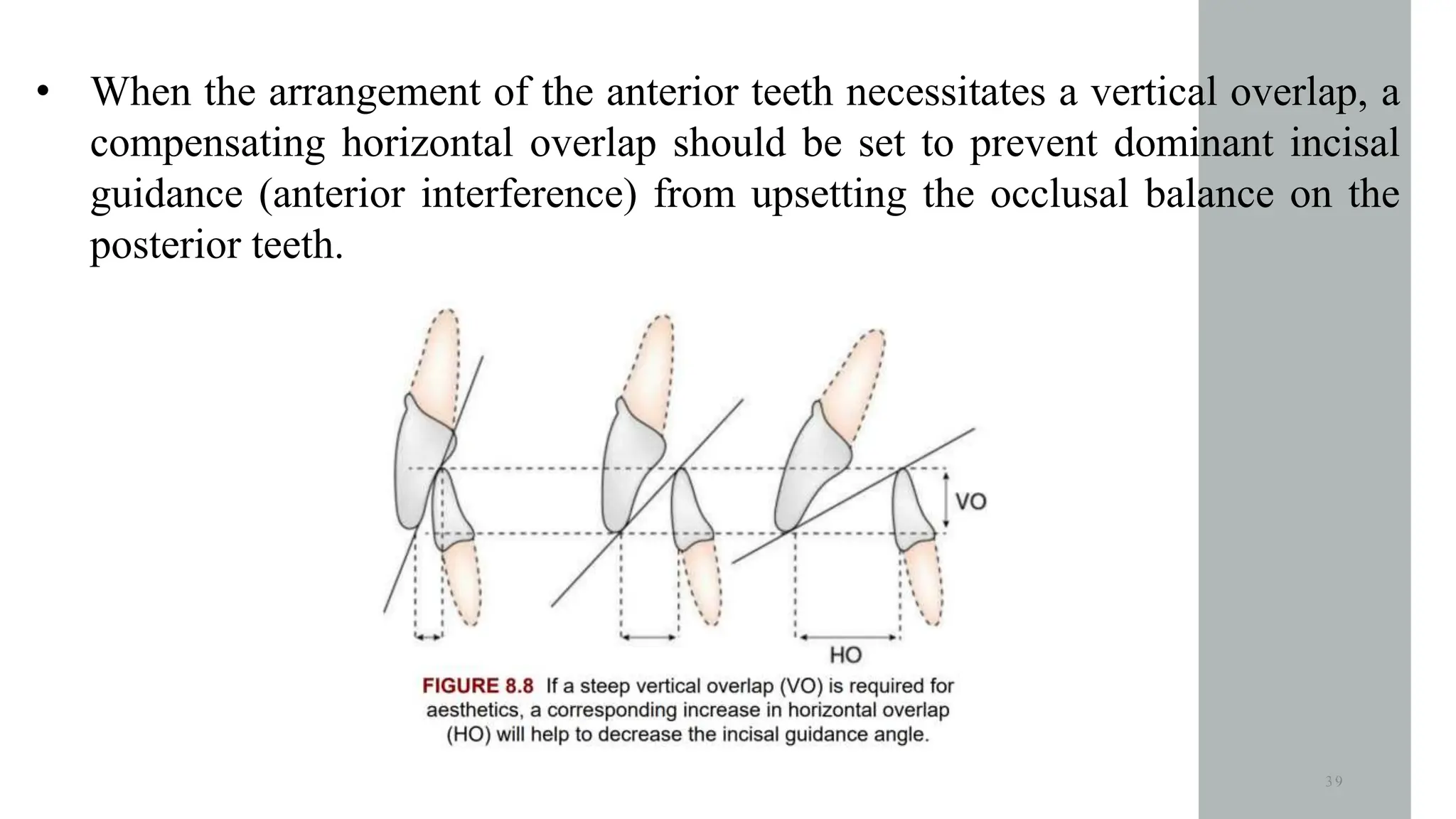 Occlusal schemes in CD_Dr Shuchi Jain.pptx
