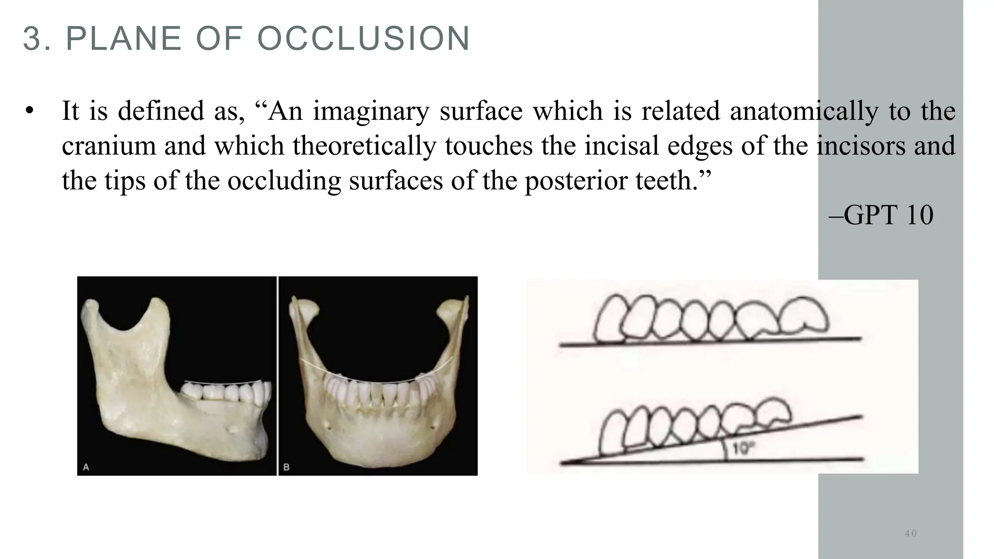 Occlusal schemes in CD_Dr Shuchi Jain.pptx