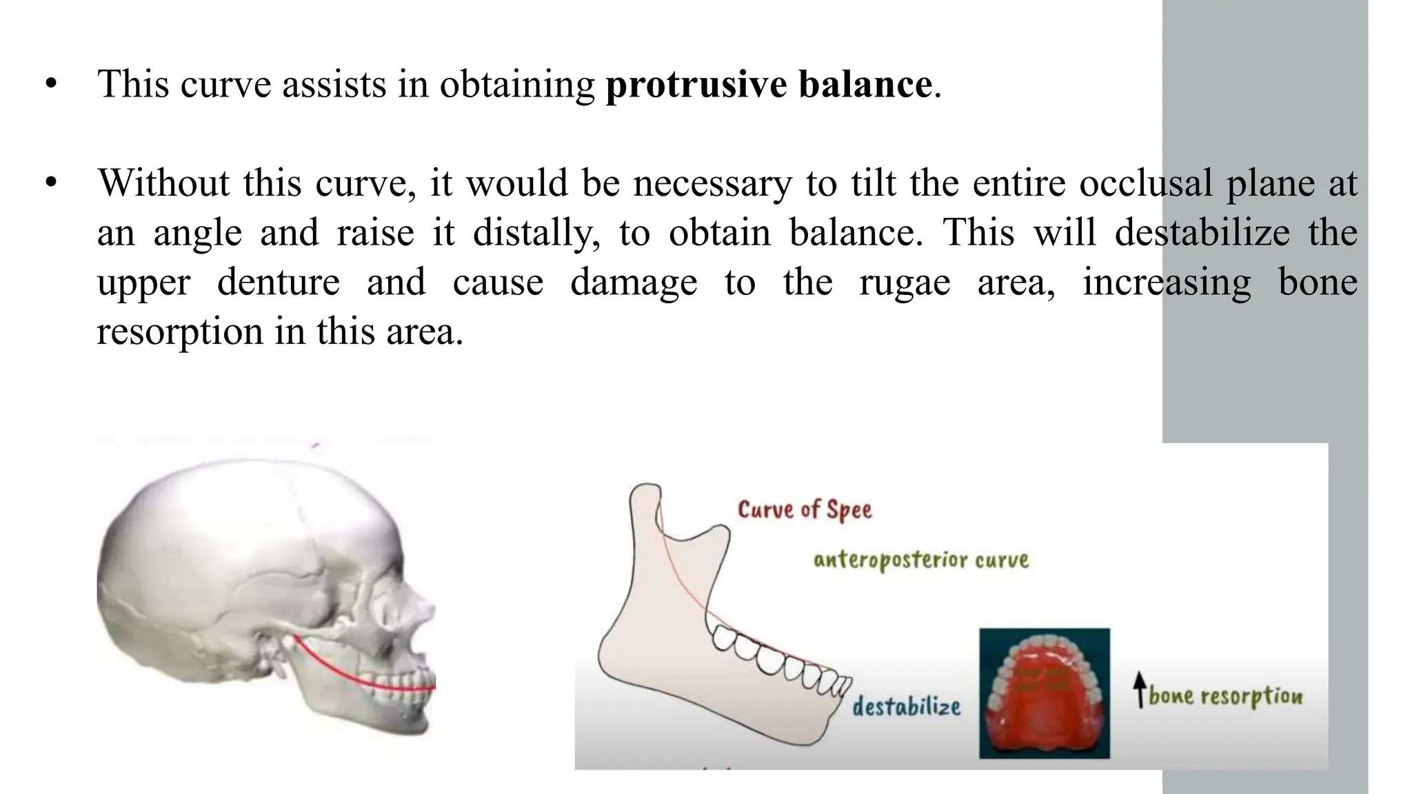 Occlusal schemes in CD_Dr Shuchi Jain.pptx