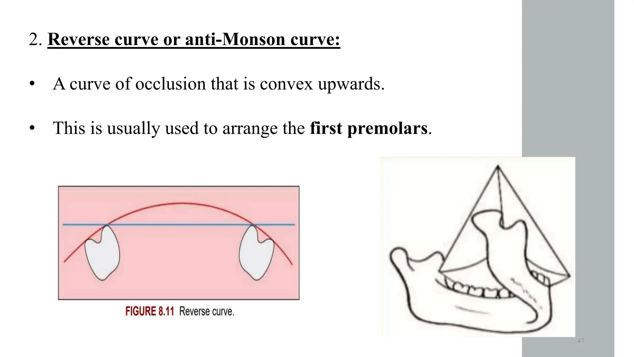 Occlusal schemes in CD_Dr Shuchi Jain.pptx