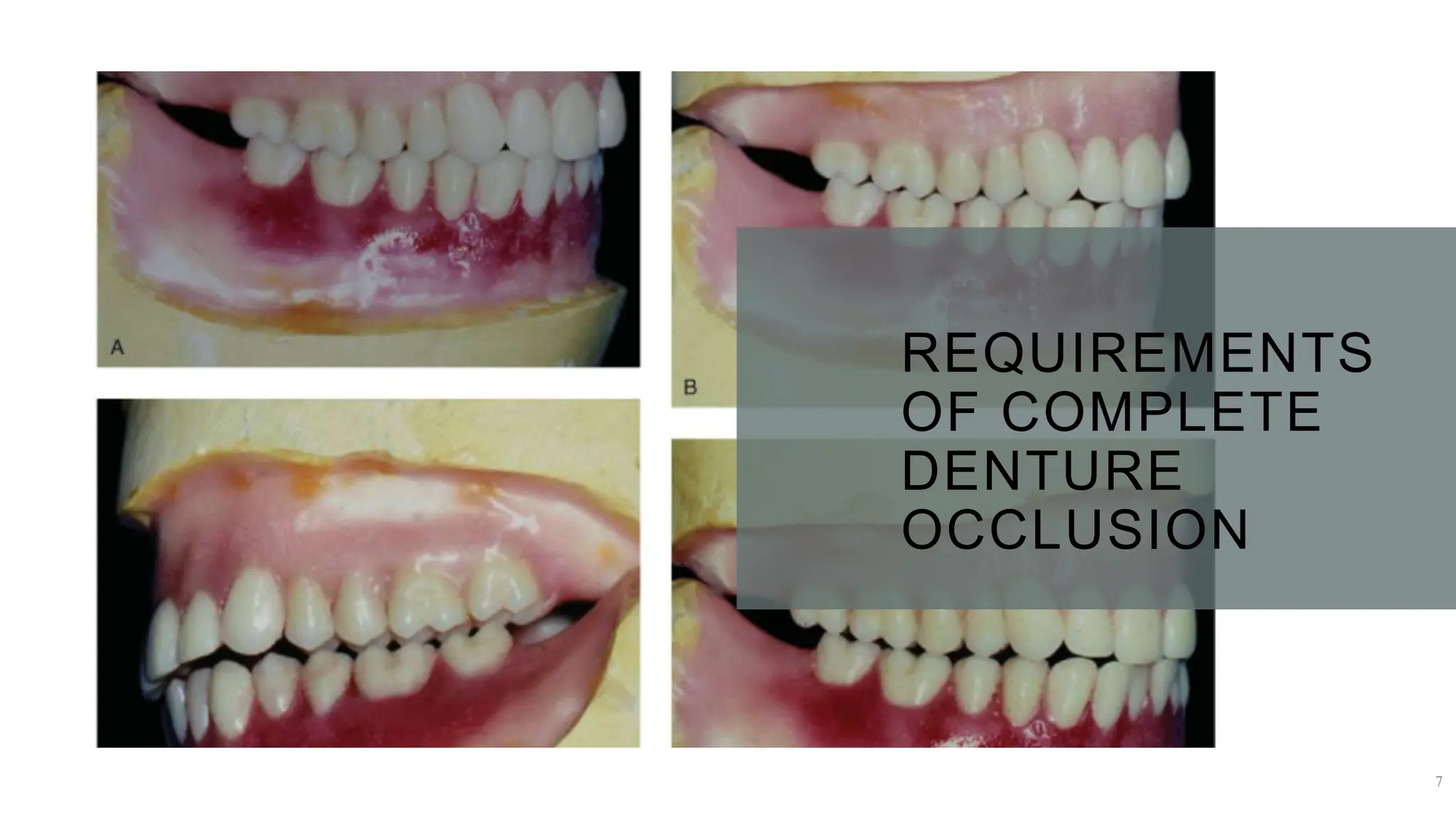 Occlusal schemes in CD_Dr Shuchi Jain.pptx