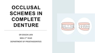 Occlusal schemes in CD_Dr Shuchi Jain.pptx